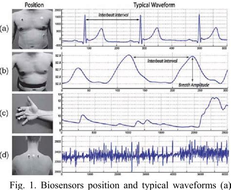Figure 2 From Using Physiological Signals For Emotion Recognition