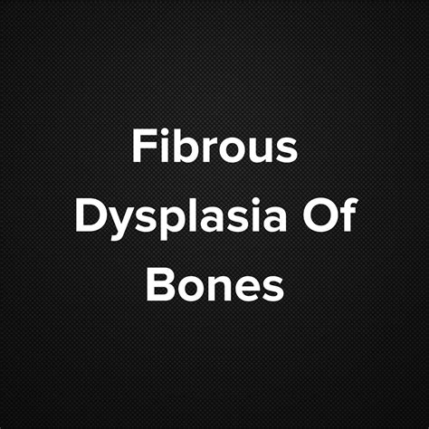 Fibrous Dysplasia Of Bones Moho