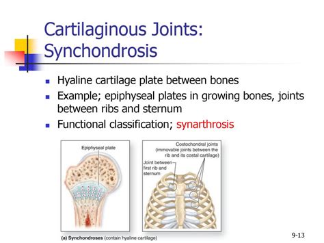 Chapter 9 Articulations Ppt Download