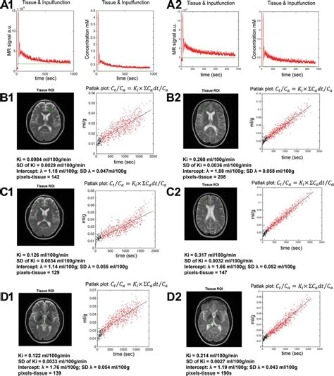 Arterial Input Function In Arbitrary Signal Units A Left And Download Scientific Diagram