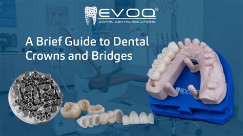 Restore Your Smile Dental Crowns And Bridges Guide