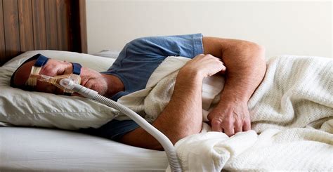 Beta Blocker Use Linked To Higher Cvd Risk In Patients With Obstructive Sleep Apnoea Hospital