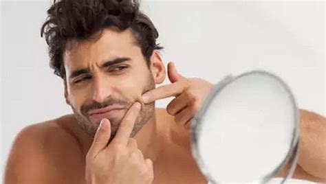 Men This Ones For You 4 Simple Ways To Win Over Pimples Health
