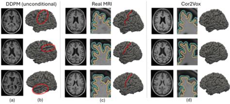 [논문 리뷰] 3d Shape To Image Brownian Bridge Diffusion For Brain Mri Synthesis From Cortical Surfaces