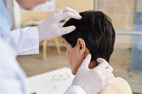 What Is Scalp Folliculitis Symptoms And Treatments
