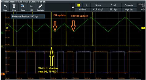Tms320f280049c Epwm Global Load Problem With Deadtime And Period Load C2000 Microcontrollers