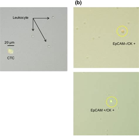 Isolated Circulating Tumor Cell Ctc With A Few Leukocytes A The Download Scientific