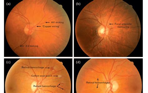 A Grading System Conclusion