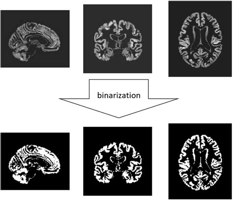 5 mri scan before and after binary voxelization download scientific