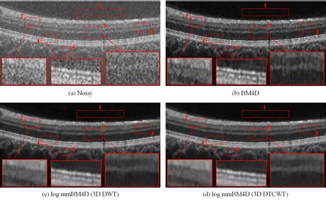 visual comparison of the 3d oct denoising results obtained by denoising