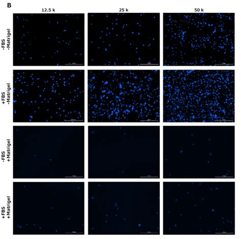 Cell Migration And Invasion Assay Guidance Using Millicell® Cell