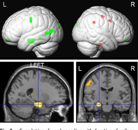 Figure 2 From Factors Affecting Reorganisation Of Memory Encoding Networks In Temporal Lobe