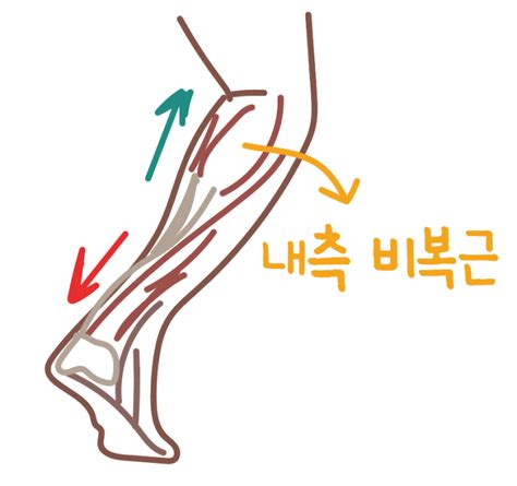 종아리에서 뚝소리가 났어요 비복근파열 장딴지근육파열 에 대한 모든것 네이버 블로그