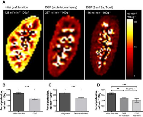 Renal Allograft Perfusion Parameter Maps Of Renal Allograft Perfusion Download Scientific