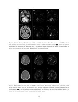 Simple Statistical Methods For Unsupervised Brain Anomaly Detection On MRI Are Competitive To