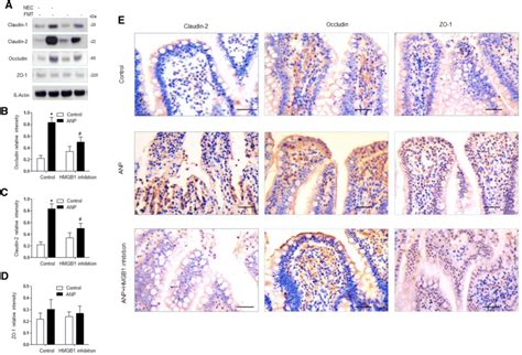 Hmgb1 Inhibition Prevents The Disruption Of Tight Junction Proteins A
