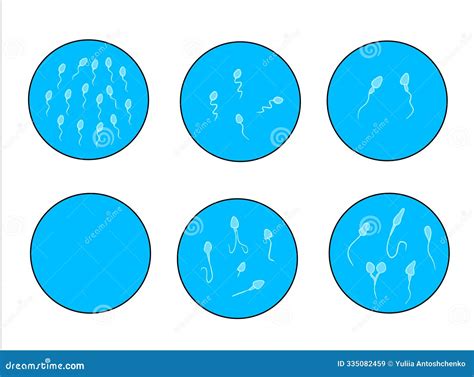 Vector Isolated Illustration Of Sperm Pathologies Spermogram Sperm