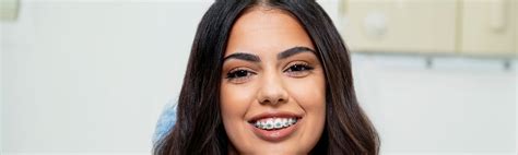 Braces In Long Beach Ca