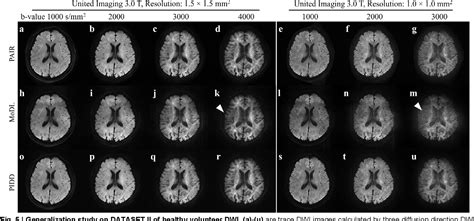Figure 1 From Physics Informed Deep Diffusion Mri Reconstruction With Synthetic Data Break