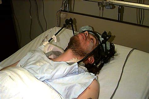 THE DIFFICULT INTUBATION Emergency Medicine