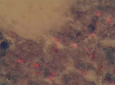 Github Richardyu114weakly Segmentation With Bounding Box Ideas From