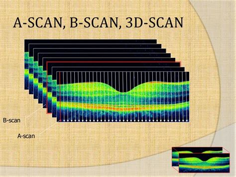 Principles Of Optical Coherence Tomography