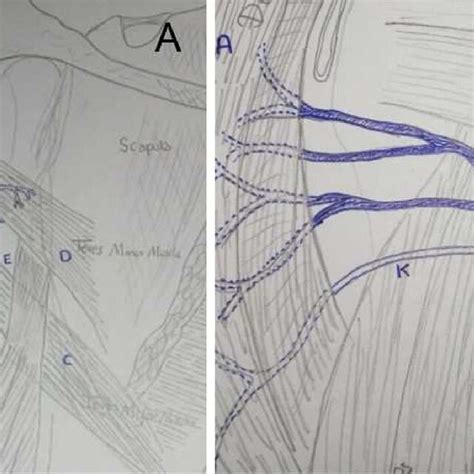 Drawn Diagrams By The Authors Showing The Axillary Nerve And Its Download Scientific Diagram