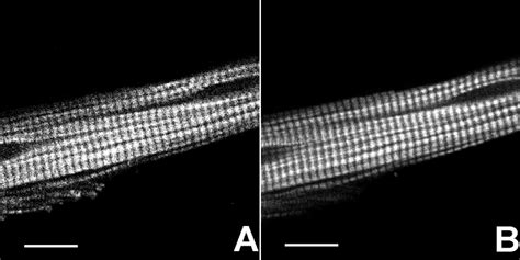 Sarcomeric Structure Of An Adult Cardiomyocyte Acquired By The Shg Download Scientific Diagram