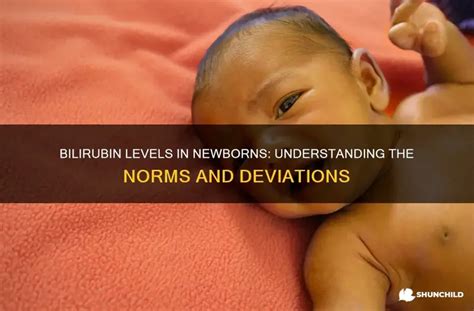 Bilirubin Levels In Newborns Understanding The Norms And Deviations