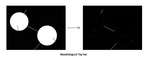 Python Medical Image Segmentation With Cv2 Stack Overflow