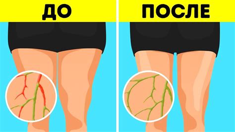 6 простых упражнений для похудения без диет Youtube