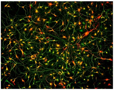 Cortical Gabaergic Neurons Human Ipsc Derived Cells Male Wc 30 Ab315368 Abcam
