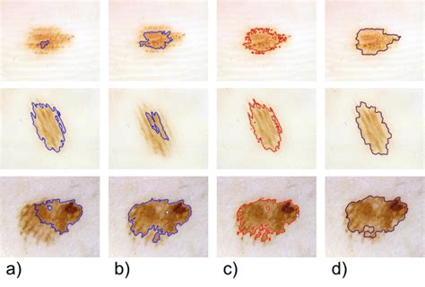 Segmentation Results Obtained Using Different Approaches A Active