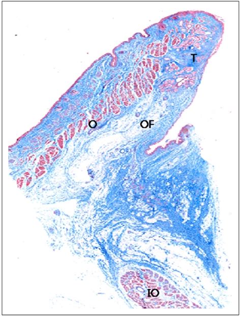 Microscopic View Of Cross Section Of Asian Lower Eyelid Masson