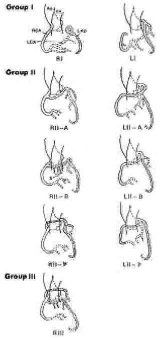 Uptons Proposed Classification Of Isolated Single Coronary Artery Key