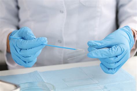 What Are The Asccp Guidelines Cervical Cancer Screening And Management