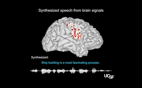 Scientists Take A Step Toward Decoding Speech From The Brain