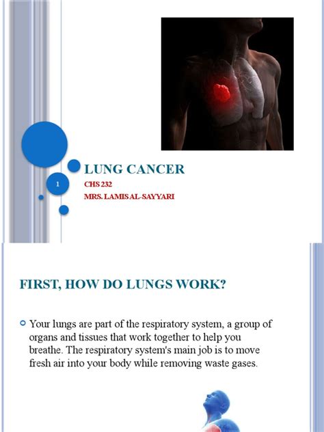 l 9 lung cancer pdf lung cancer cancer