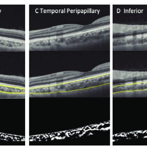 Horiztonal OCT Scans Where The Top Image Is The Initial OCT Scan Download Scientific Diagram