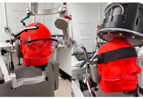 Pipeline For Planning And Execution Of Transcranial Ultrasound