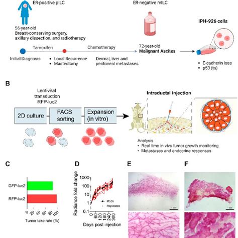 Focus Of Solid Papillary Carcinoma Showing A Monotonous Population Of