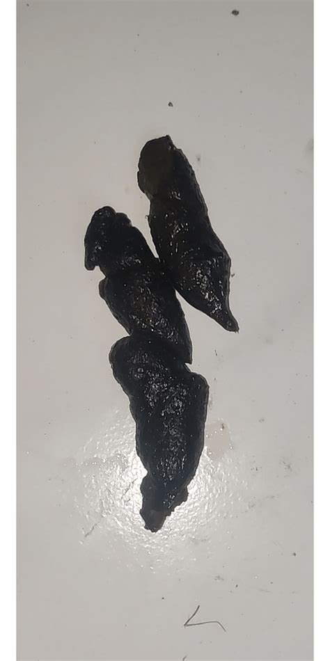 Internal Bleeding Stool Why Do I Have Blood In My Stool