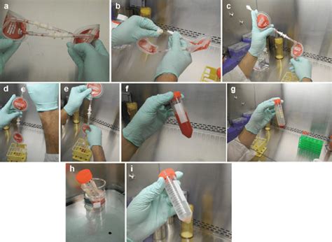Extraction Of Bone Marrow Mononuclear Cells Bmmnc From Marrow Download Scientific Diagram