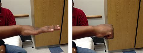 11 Extensor Indicis Proprius To Extensor Digitorum Communis Tendon Transfer Plastic Surgery Key