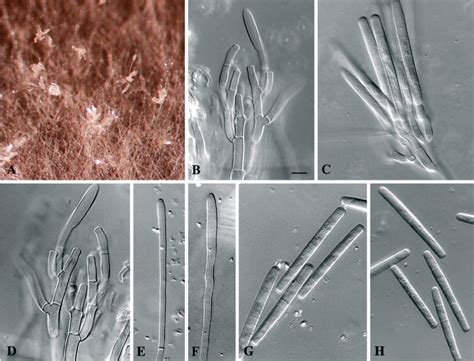 Cylindrocladium Australiense A Sporulation On Mea Bd Conidiophores