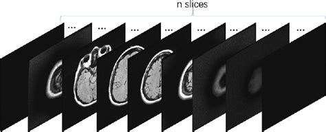 Figure 1 From Sasg Gcn Self Attention Similarity Guided Graph