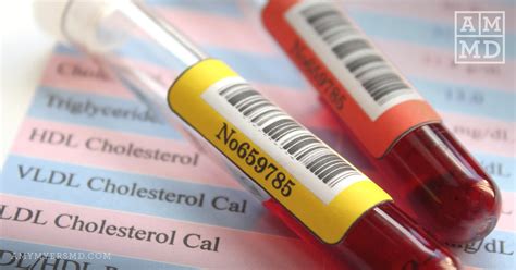 Your Lipid Panel Test What Your Doctor Isnt Telling You Amy Myers Md