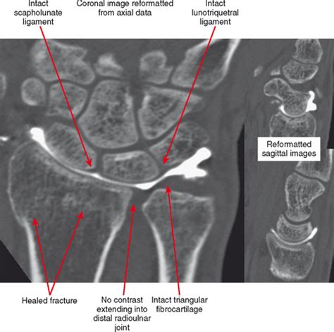 Arthrography And Joint Injection And Aspiration Principles And