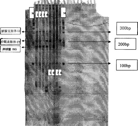 Kit For Detecting Sexually Transmitted Diseases Eureka Patsnap