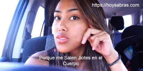 Porque Me Salen Jiotes En El Cuerpo 2026